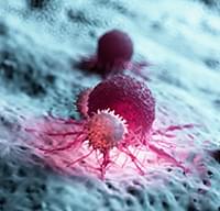 Keto Breads: Your Guide to Baking Grain-Free Keto Bread